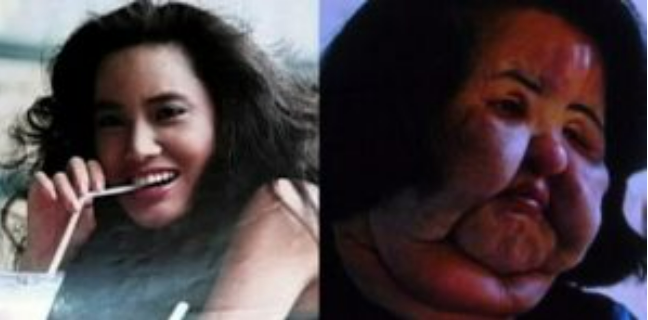 The famous model who had oil injected into her face, see what she ...